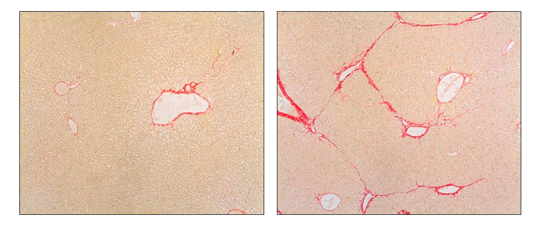 CCl4-induced liver fibrosis model | SMC Laboratories Inc.