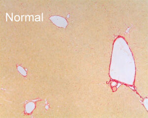 Bile duct ligation (BDL) model | SMC Laboratories Inc.