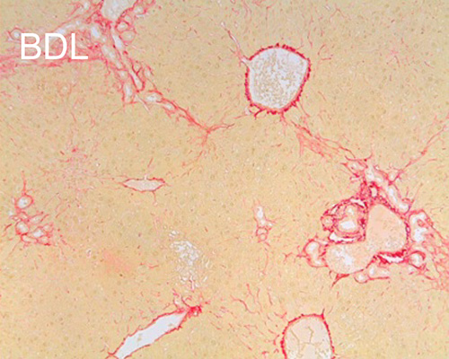 Bile duct ligation (BDL) model | SMC Laboratories Inc.