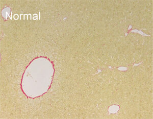 CCl4-induced liver fibrosis model | SMC Laboratories Inc.