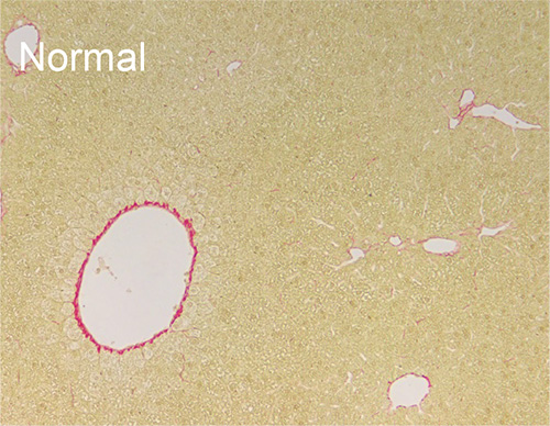 CCl4-induced liver fibrosis model | SMC Laboratories Inc.