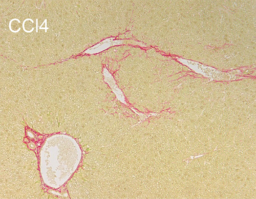 CCl4-induced liver fibrosis model | SMC Laboratories Inc.