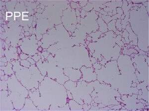 Porcine Pancreatic Elastase (PPE) model | SMC Laboratories Inc.
