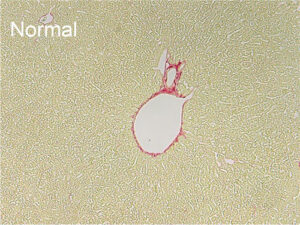 DEN-CCl4 liver cancer model | SMC Laboratories Inc.