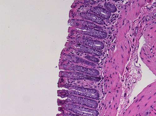DSS-induced colitis model | SMC Laboratories Inc.