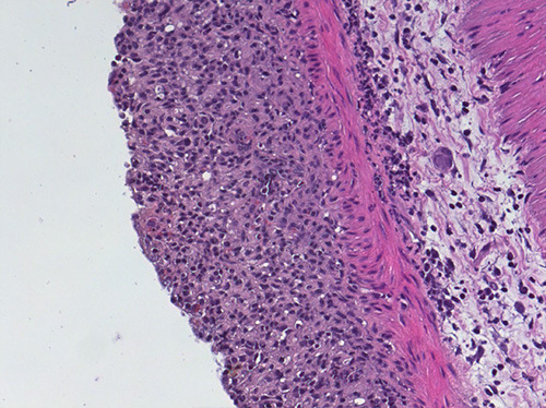 DSS-induced colitis model | SMC Laboratories Inc.