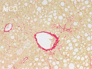 MCD model | SMC Laboratories Inc.