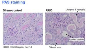 UUO-induced renal fibrosis model | SMC Laboratories Inc.