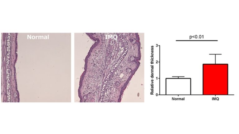 Introducing our skin disease model: Imiquimod (IMQ)-induced psoriasis ...